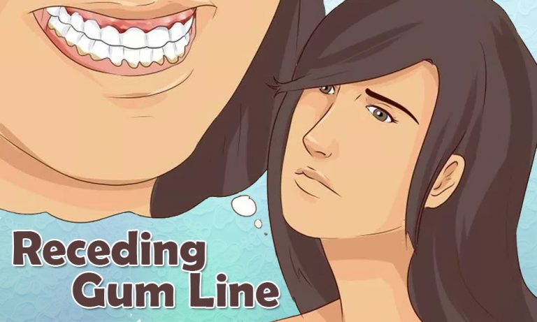 Receding Gum Line, Simple Treatments and Tips - OraMD Blog